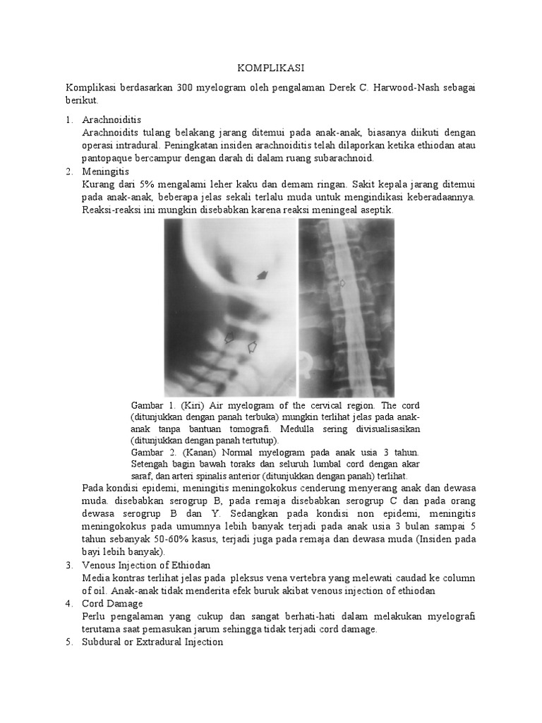 Komplikasi Myelografi pada Anak-anak | PDF