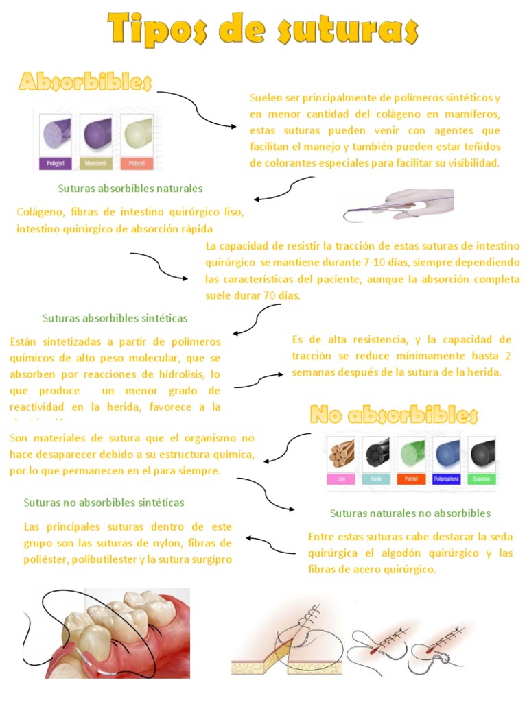 Tipos de Suturas | PDF