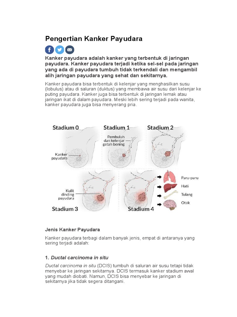 Pengertian Kanker Payudara | PDF