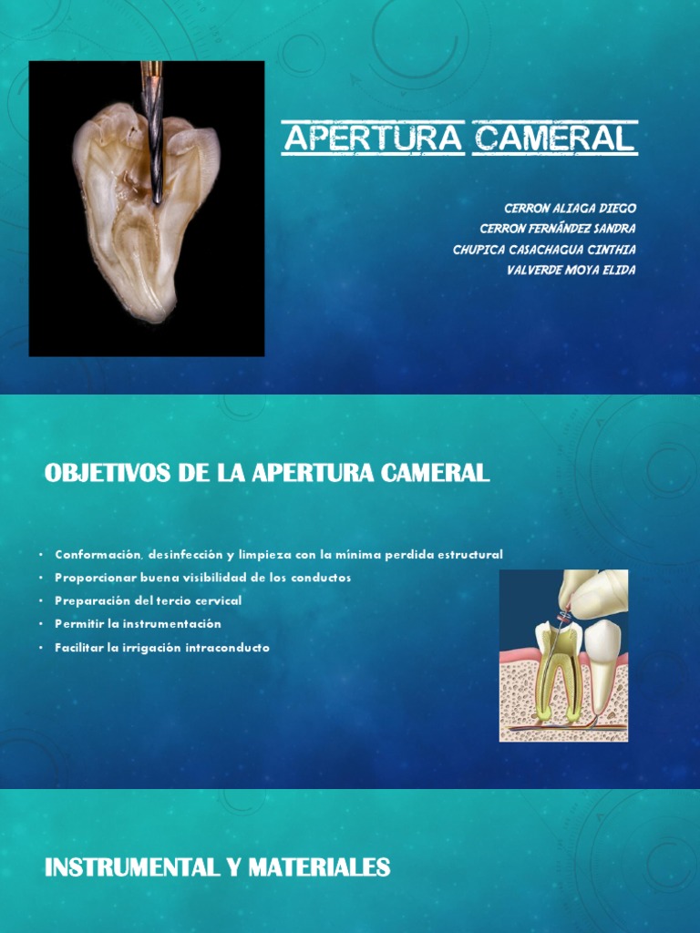 Apertura Cameral | PDF