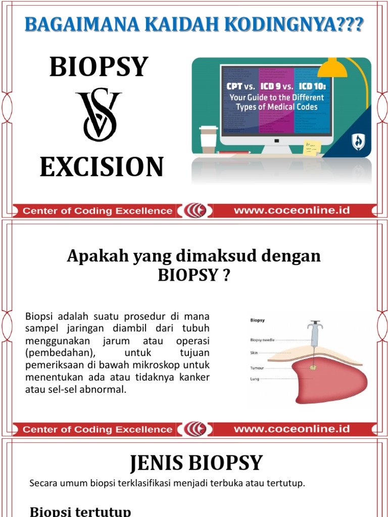 Biopsy Vs Excision Edited | PDF