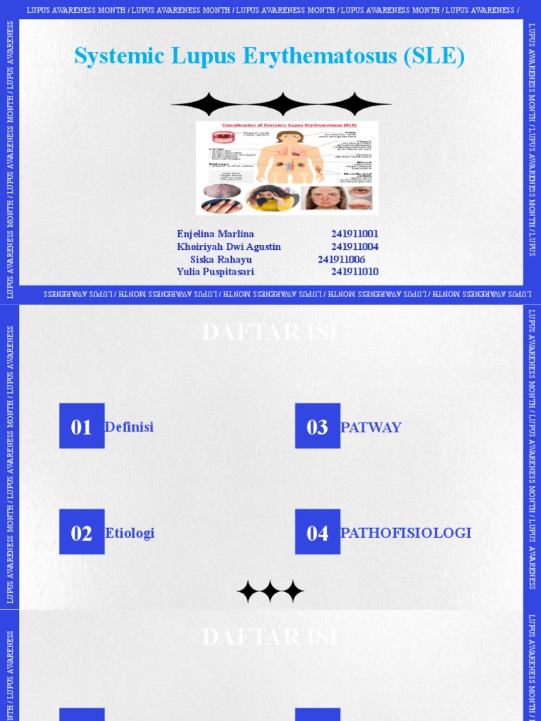 Systemic Lupus Erythematosus (SLE) | PDF