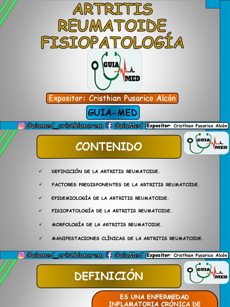 Artritis Reumatoide Parte 1 (Fisiopatologia) | PDF | Artritis ...