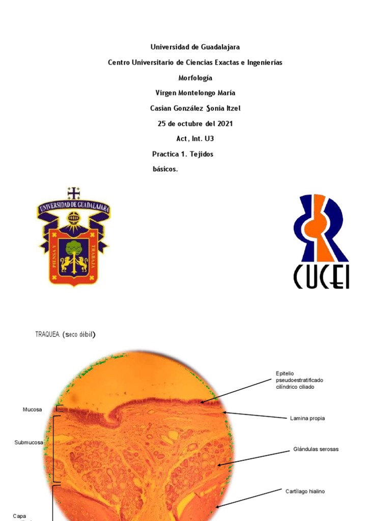 Act. Int.U3 Práct. 1. Casian Gonzalez Sonia Itzel | PDF | Membrana mucosa | Epitelio