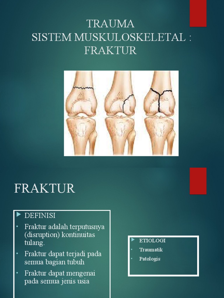 Trauma Sistem Muskuloskeletal: Fraktur | PDF