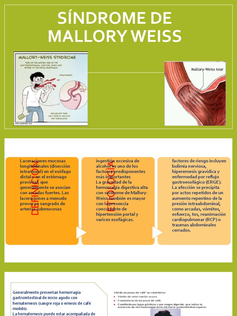 Síndrome de Mallory Weiss | PDF | Vómitos | Medicina CLINICA