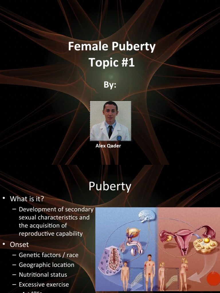 Understanding Female Precocious Puberty | PDF | Puberty | Clinical Medicine