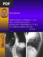 Test de Adams | PDF | Escoliosis | Especialidades Medicas