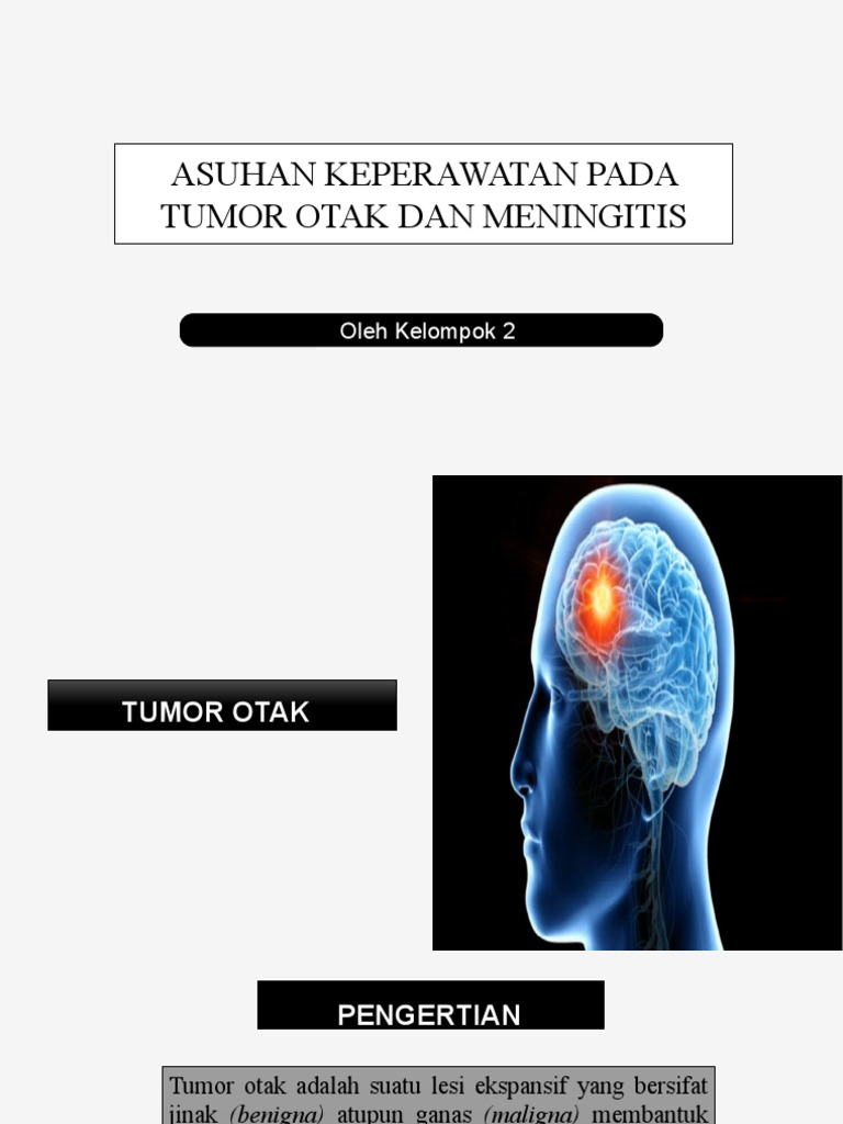 Tumor Meningitis | PDF | Sains & Matematika