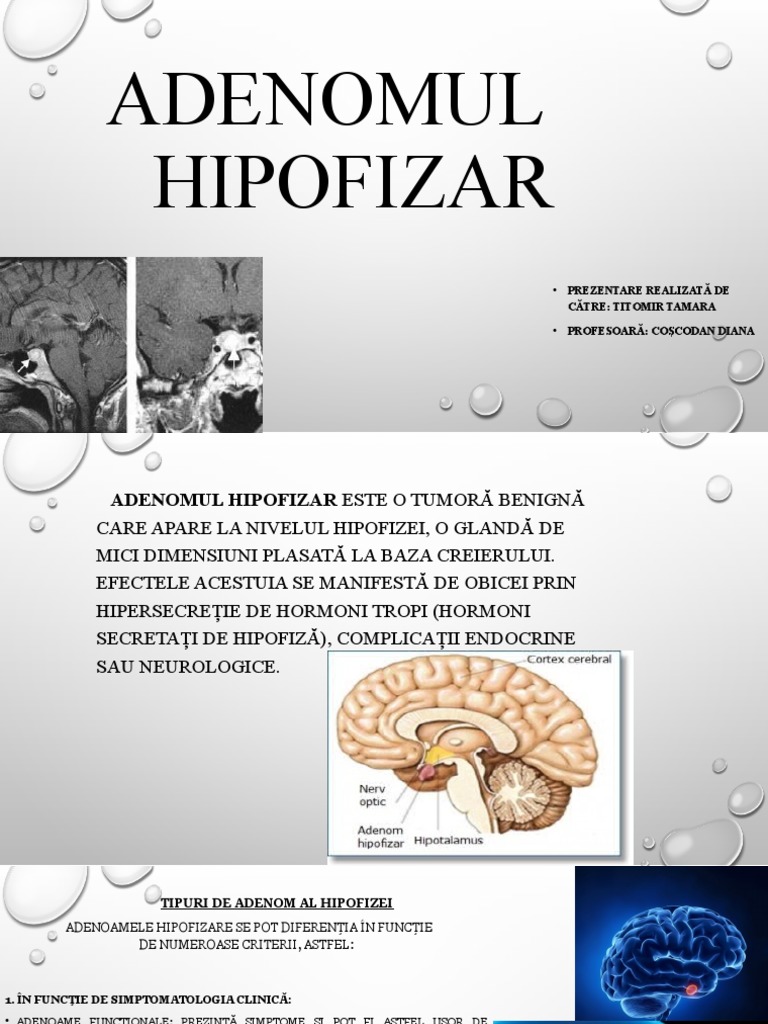 Adenomul Hipofizar | PDF