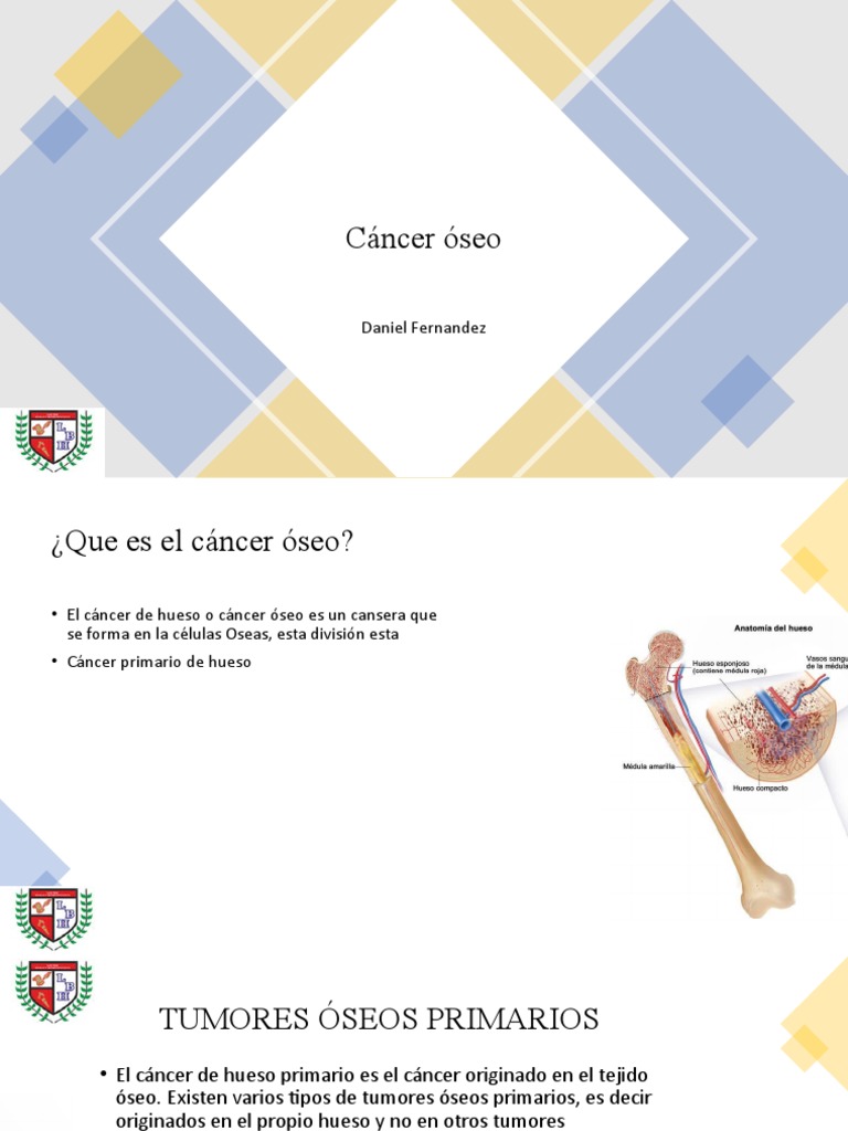 Cancer Oseo | PDF