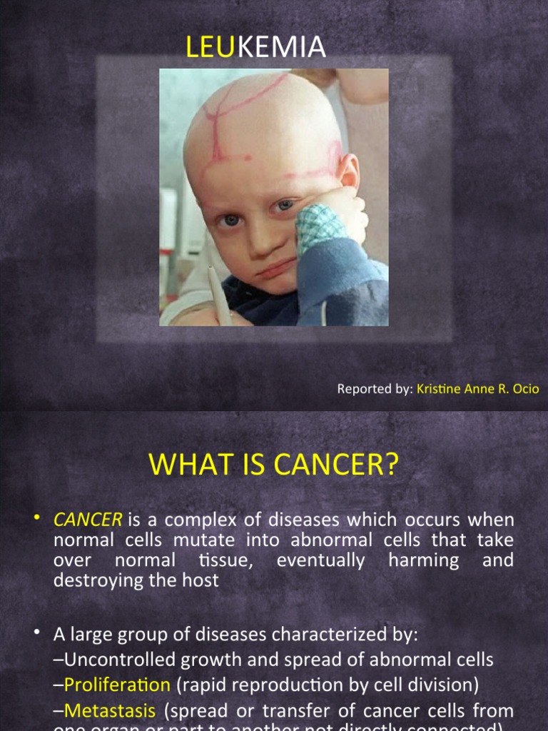 Understanding Leukemia: Overview and Impact | PDF | Leukemia | Metastasis