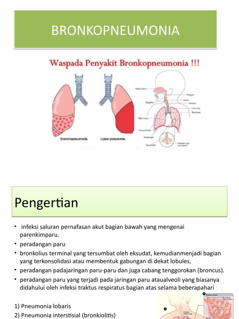 1 Ppt. Bronkopneumonia | PDF