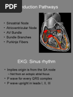 Left Anterior Fascicular Block (LAFB) - LITFL - ECG Library Diagnosis ...