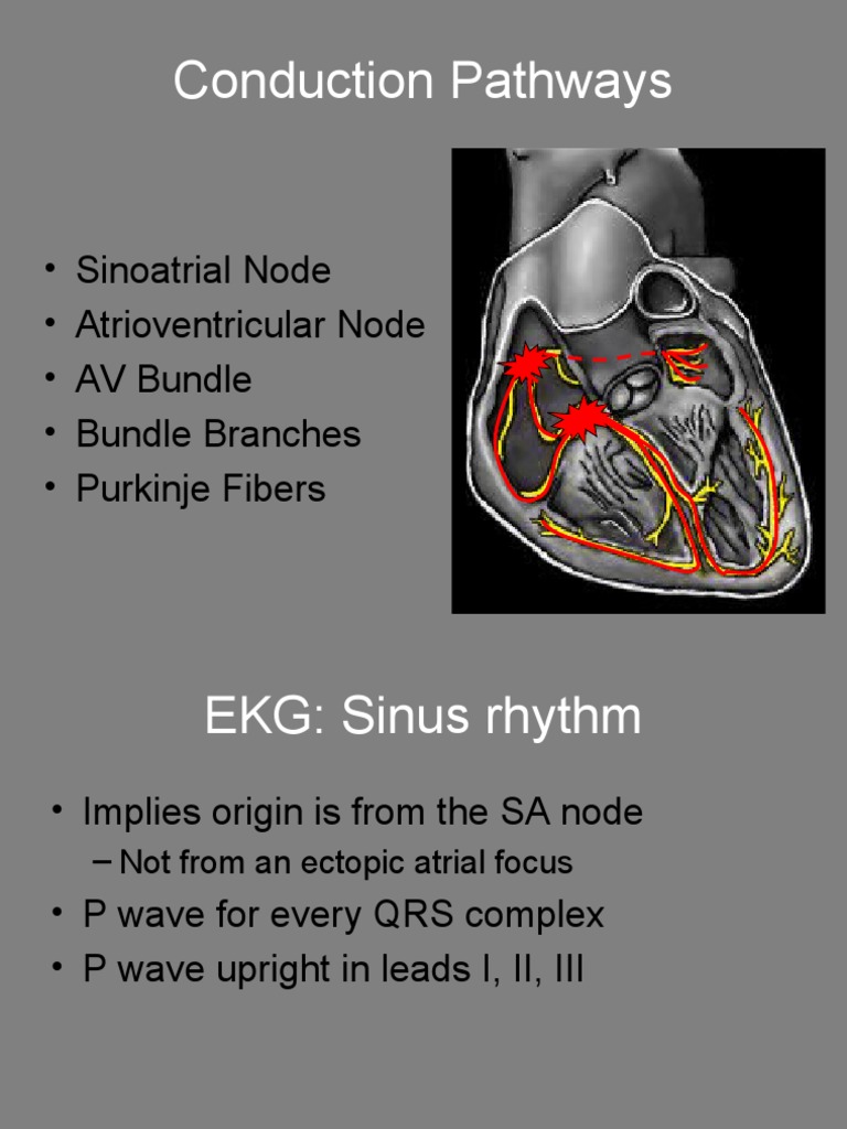 Conduction Pathways: - Sinoatrial Node - Atrioventricular Node - AV ...