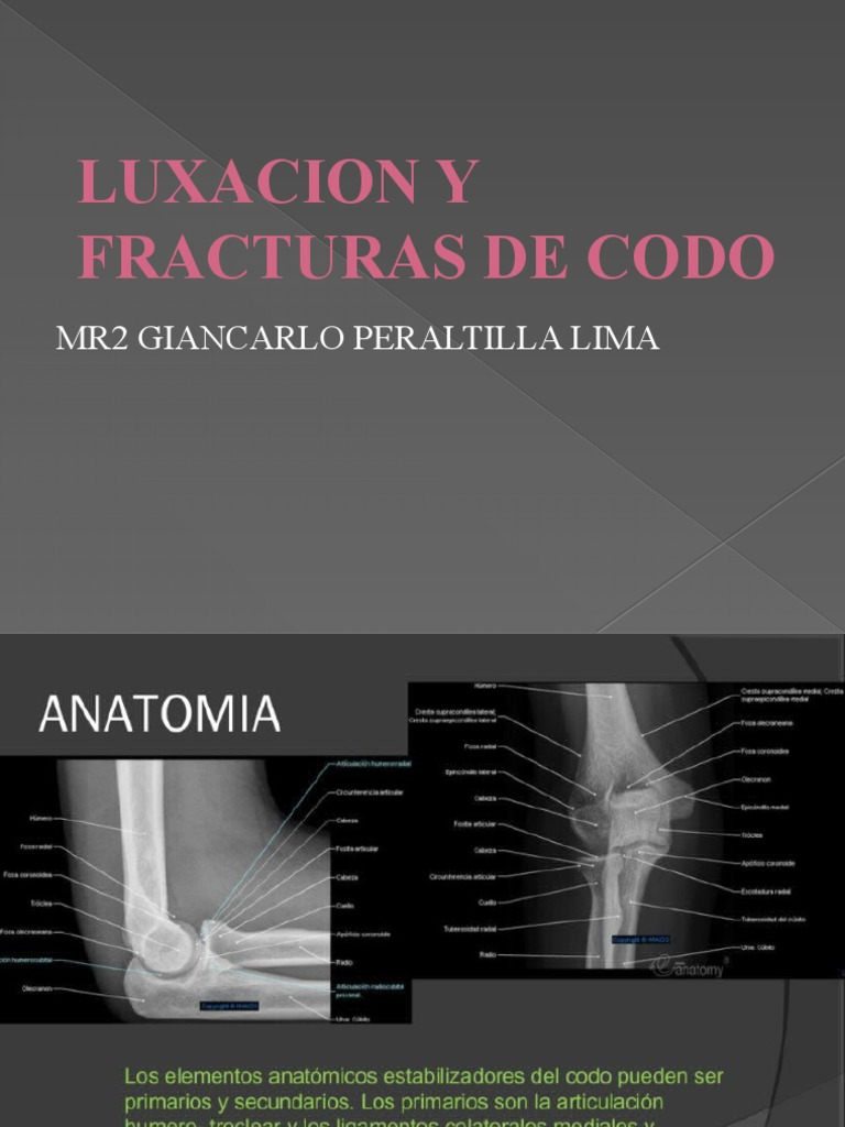 Tratamiento exitoso de la triada terrible del codo sin fijación de ...