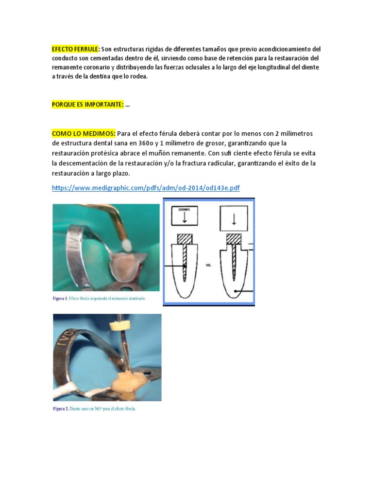 Efecto Ferrule | PDF