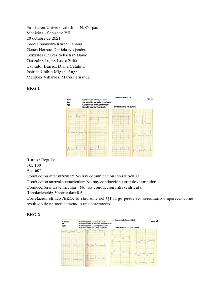 Taller Ekg | PDF | Electrocardiografia | Órgano (anatomía)