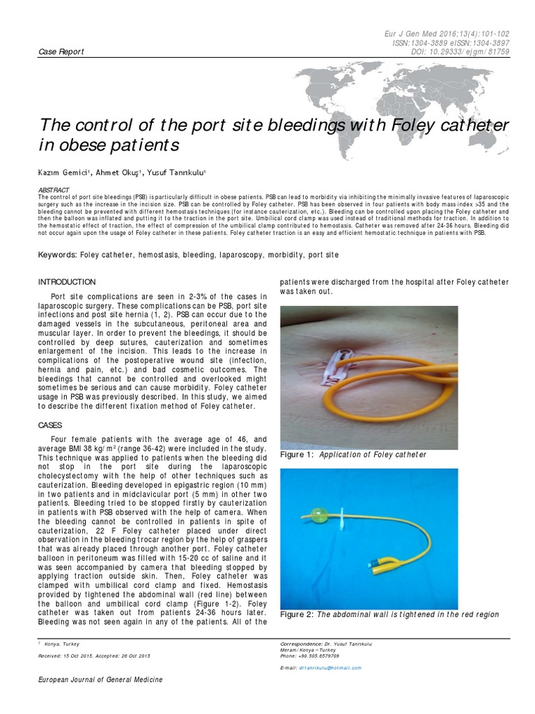 The Control of The Port Site Bleedings With Foley Catheterin Obese ...