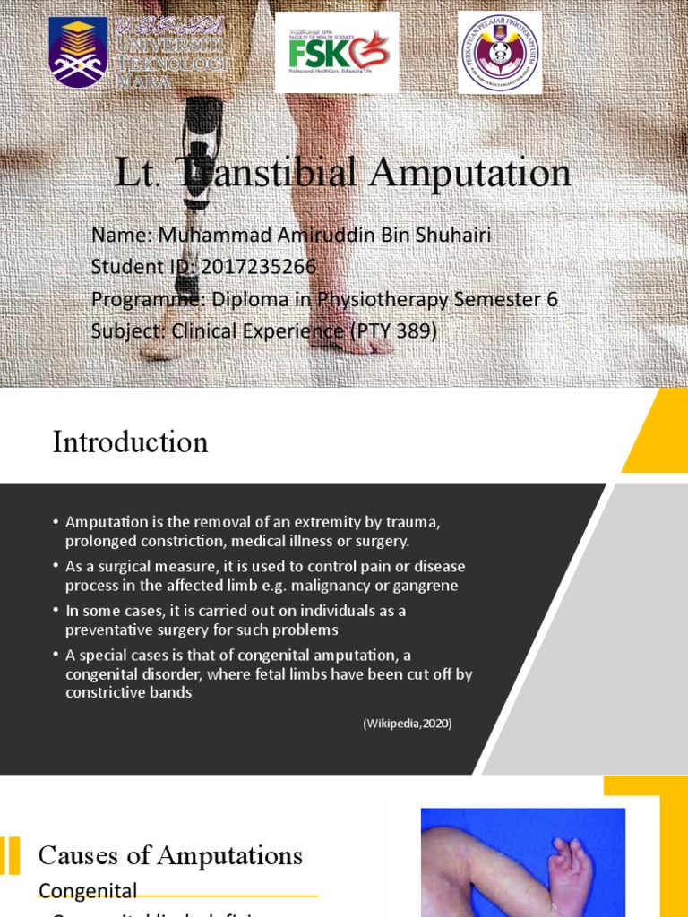 Lt. Transtibial Amputation | PDF | Amputation | Prosthesis