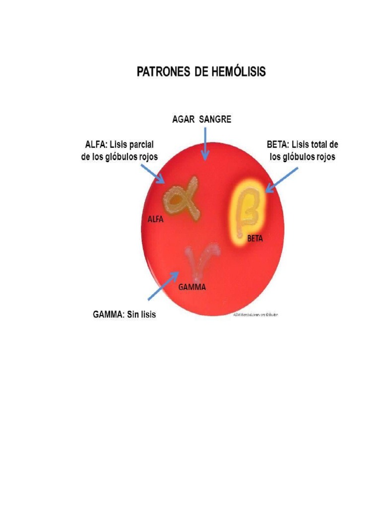 Diferentes Tipos de Hemolisis | PDF