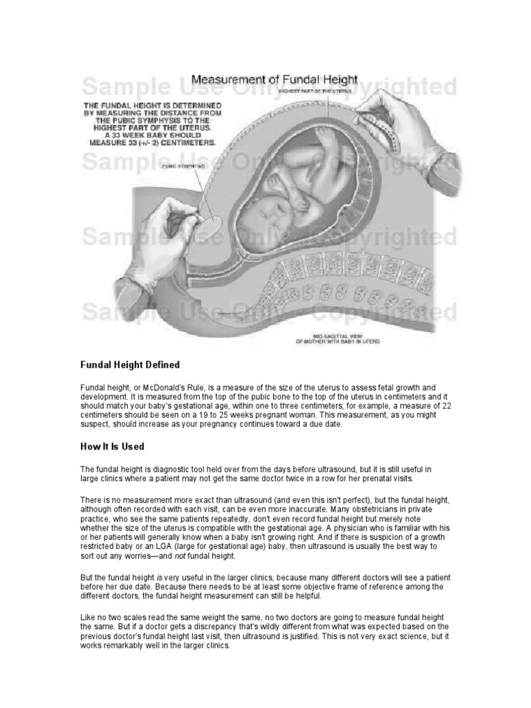 Fundal Height Defined | PDF | Prenatal Development | Pregnancy
