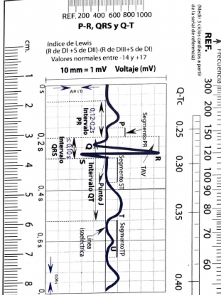 Tabla de EKG | PDF | Electrocardiografia | Imagenes medicas