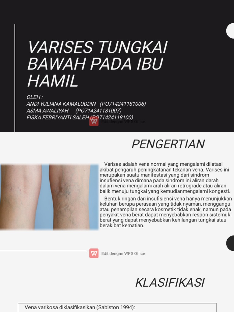 Varises pada Ibu Hamil dan Penyebabnya | PDF
