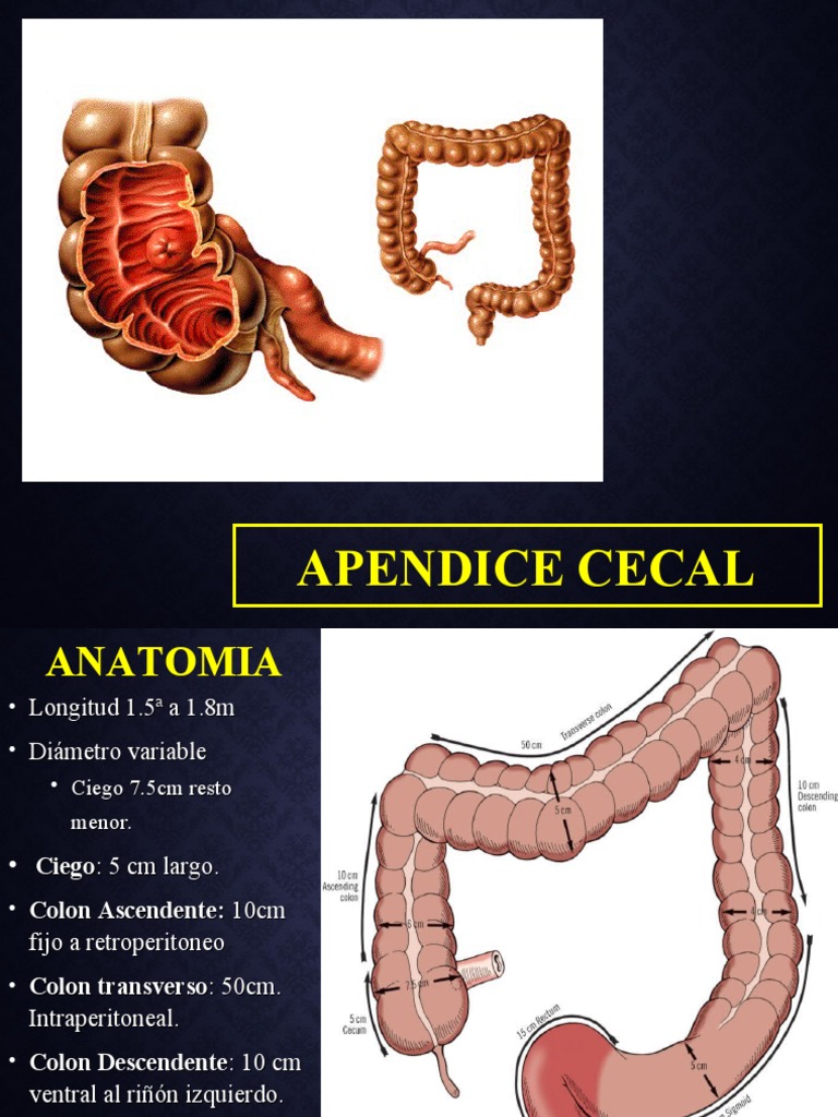 Bases Anatomicas y Clinica Del Apendice | PDF | Intestino grueso ...