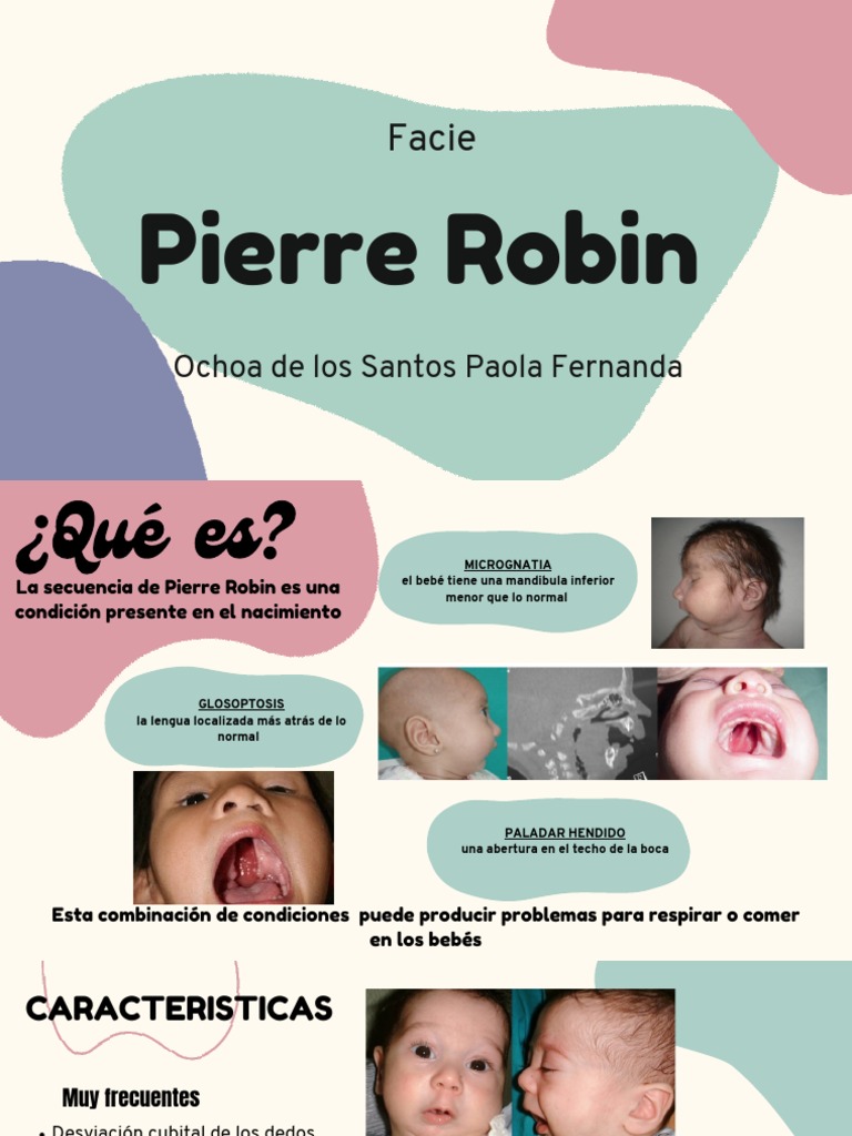 Facie de Pierre Robin | PDF | Enfermedades y trastornos humanos ...