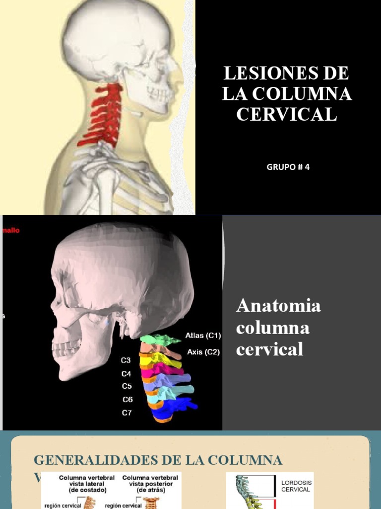 Lesiones Columna Cervical | PDF | La columna vertebral | Vértebra