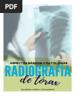 Proyecciones Rx de Tórax: PA y AP | PDF | Tórax (anatomía humana ...