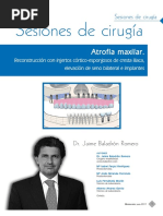 2.3 Tiempos de La Exodoncia Con Forceps y Con Elevadores | PDF | Ramas ...