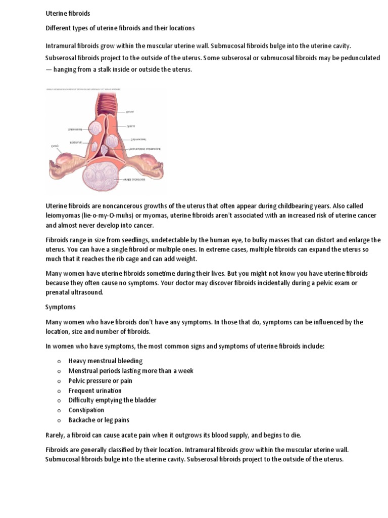 Case Study - Uterine Fibroids | PDF | Uterus | Pregnancy