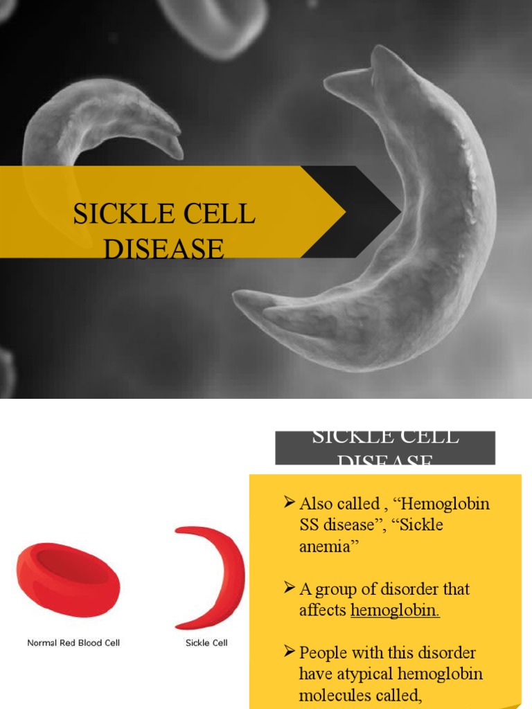 Sickle Cell Disease | PDF | Hemoglobin | Epidemiology