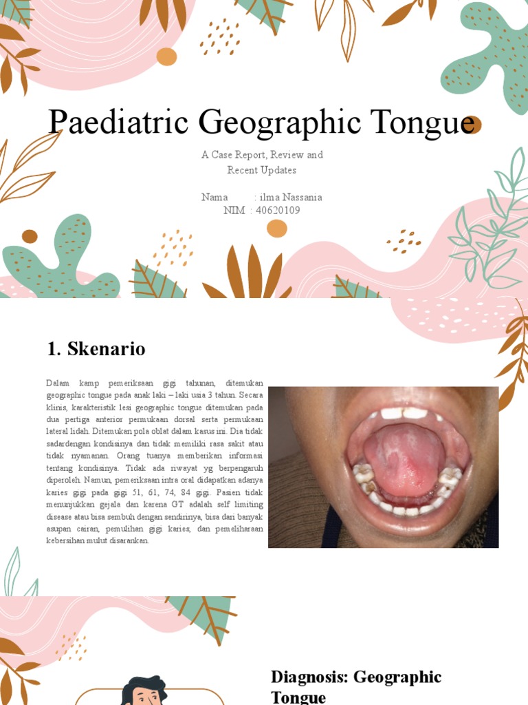 Pediatric Geographic Tongue Pdf