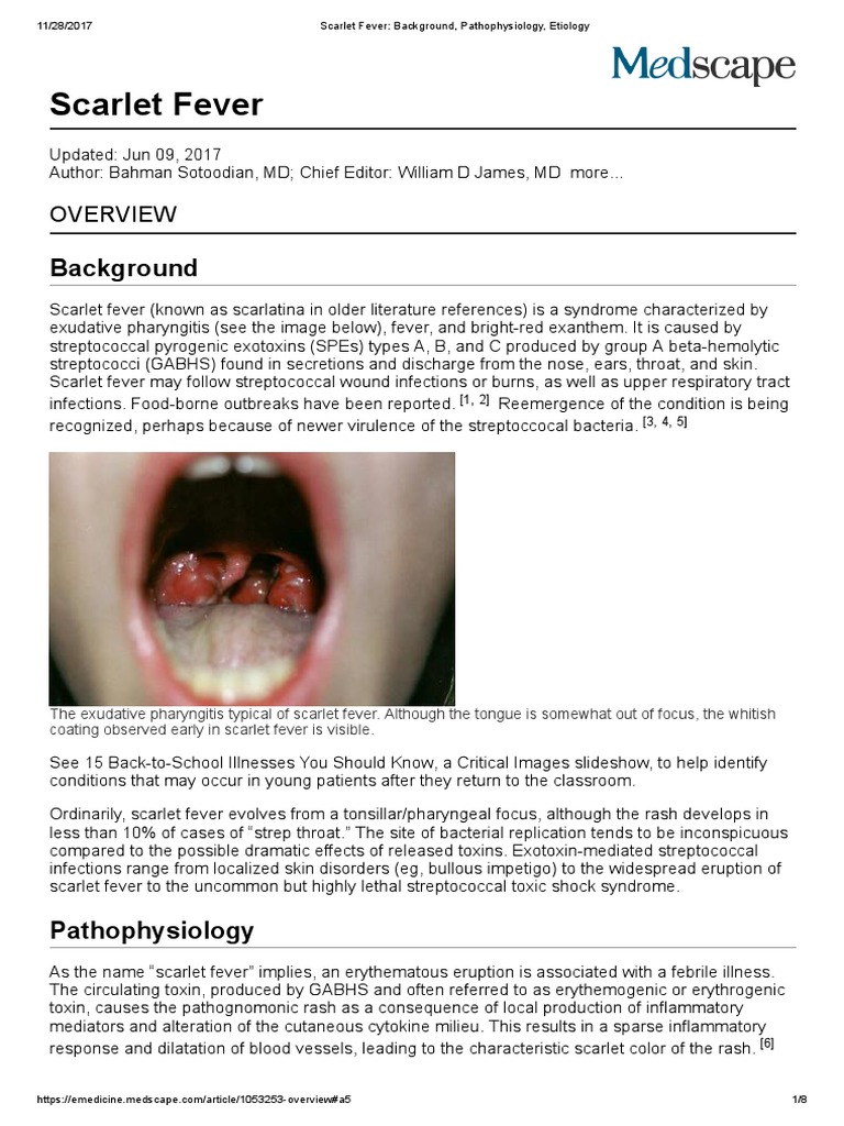 Scarlet Fever: Pathophysiology Overview | PDF | Streptococcus | Infection