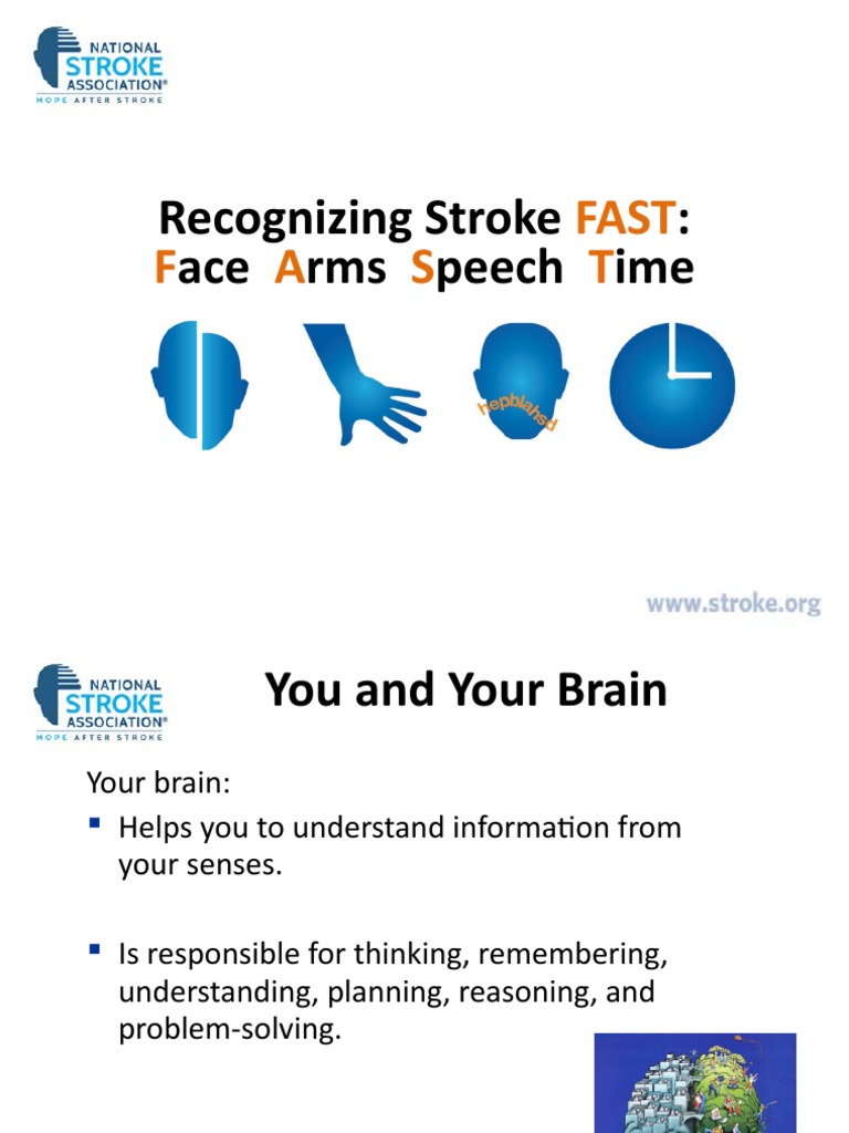 Fast F A S T: Recognizing Stroke: Ace Rms Peech Ime | PDF | Stroke ...