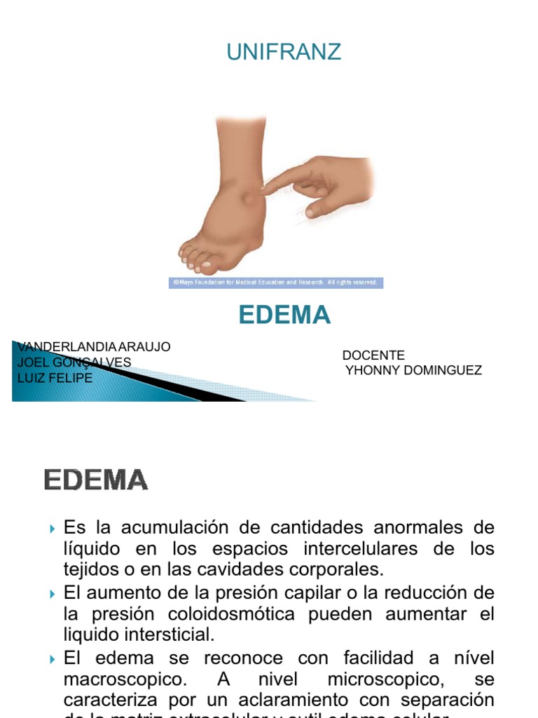 Edema | PDF | Edema | Epidemiología