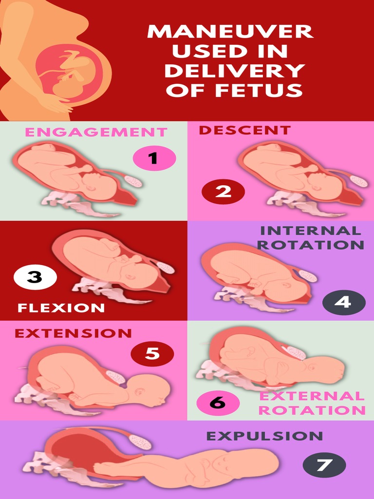 Maneuver Used in Delivery of Fetus | PDF
