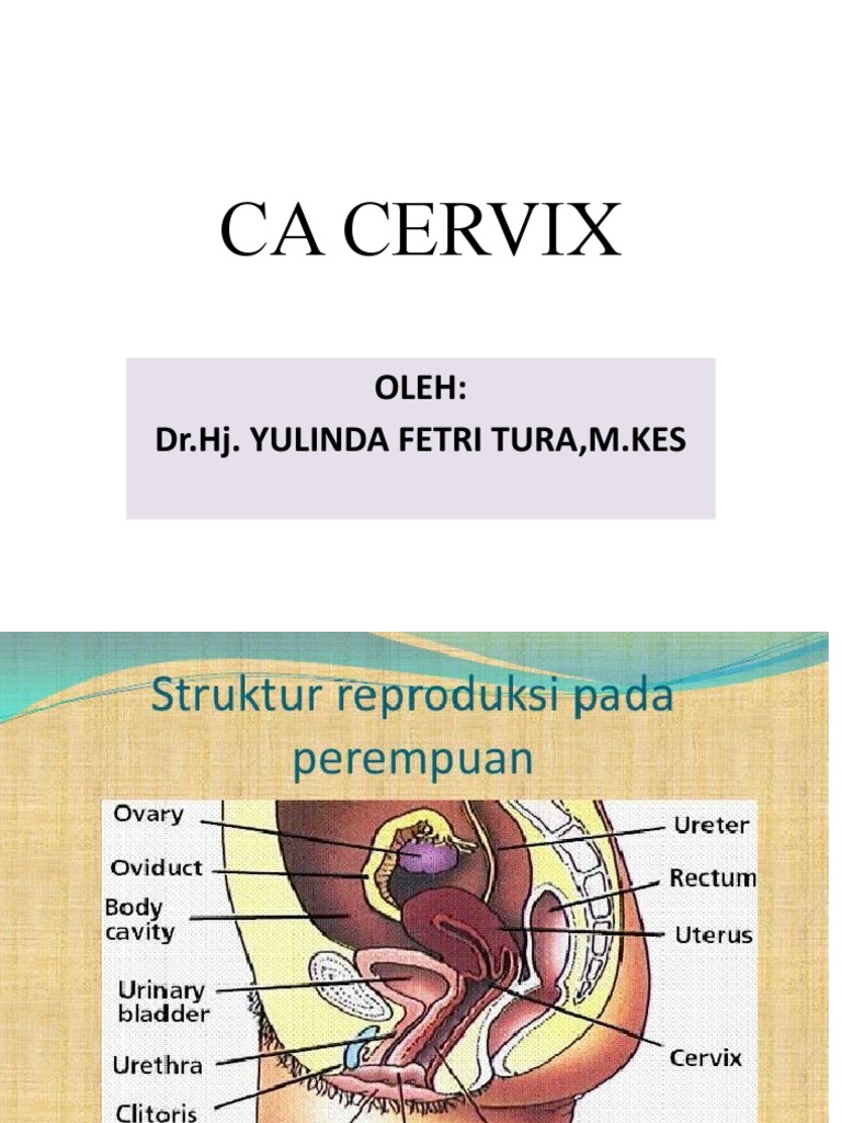 Ca Cervix | PDF