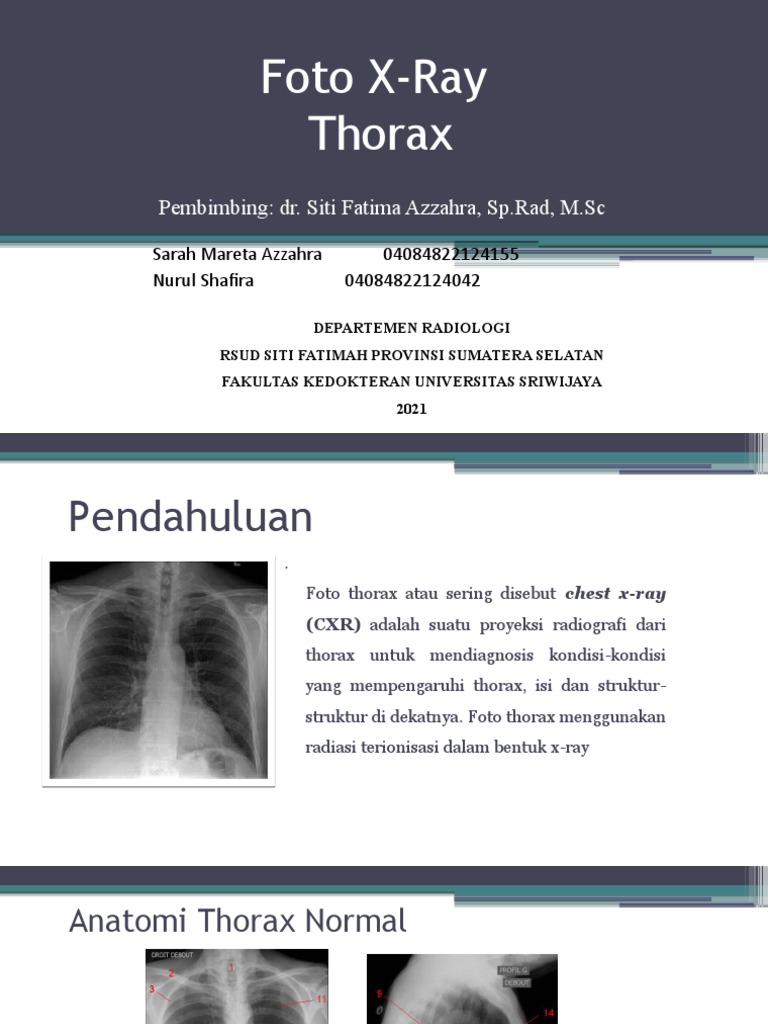 Interpretasi Foto Thorax Normal | PDF