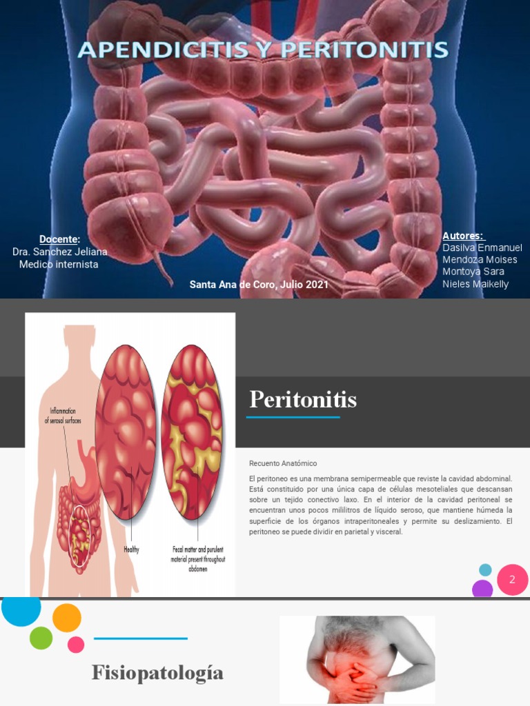 Apendicitis - Peritonitis | PDF | Medicina CLINICA | Enfermedades y ...
