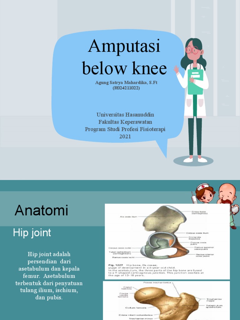 Profesi Amputasi Below Knee | PDF