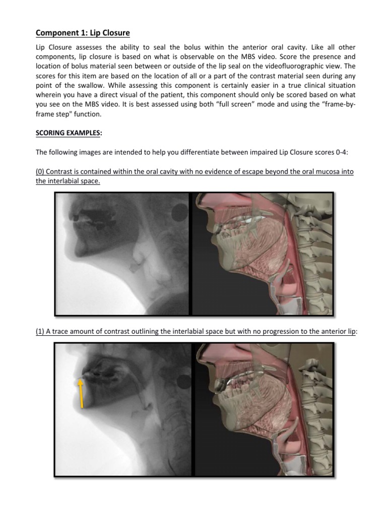 Component 1: Lip Closure: Scoring Examples | PDF | Lip | Medical ...