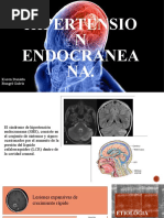 Deterioro Rostrocaudal: Etiología | PDF | Medicina | Sistema nervioso