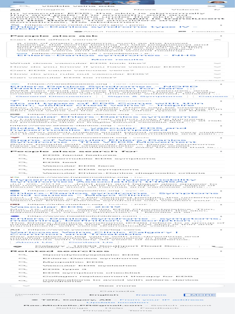 Visible Veins and Thin, Translucent Skin: Characteristic Signs of ...