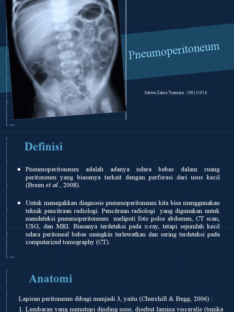 Pneumoperitoneum: Definisi, Diagnosis, dan Penatalaksanaan | PDF ...