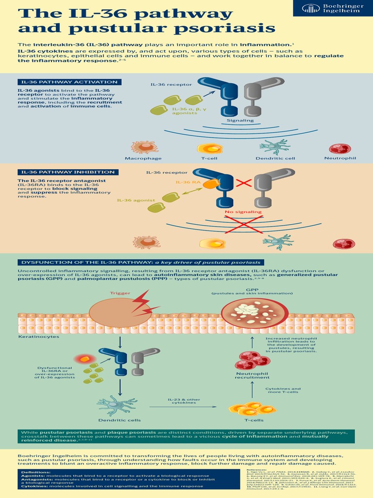 Il 36 Infographic | PDF | Inflammation | Psoriasis