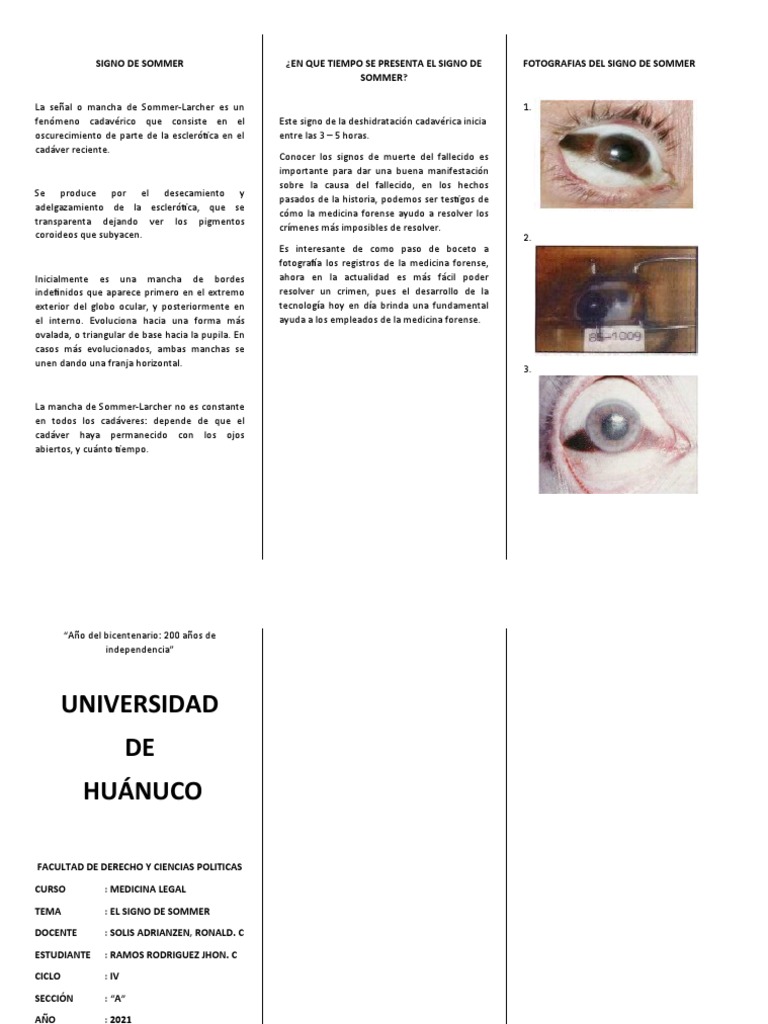 Signo de Sommer | PDF